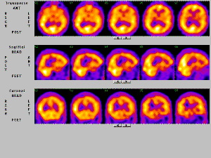 Dr. Radner - Praxis für Nuklearmedizin - Prohner Straße 12b , 18435 ...