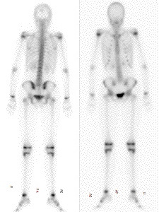 Dr. Radner - Praxis für Nuklearmedizin - Prohner Straße 12b , 18435 ...